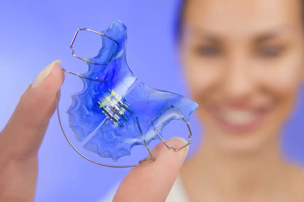 Lost Retainer? Retainers in Highland Park | Eagle Rock